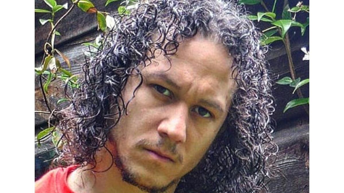 ER sieht aus wie Heath Ledger - Matthew Scar (30): "Leute starren mich an"