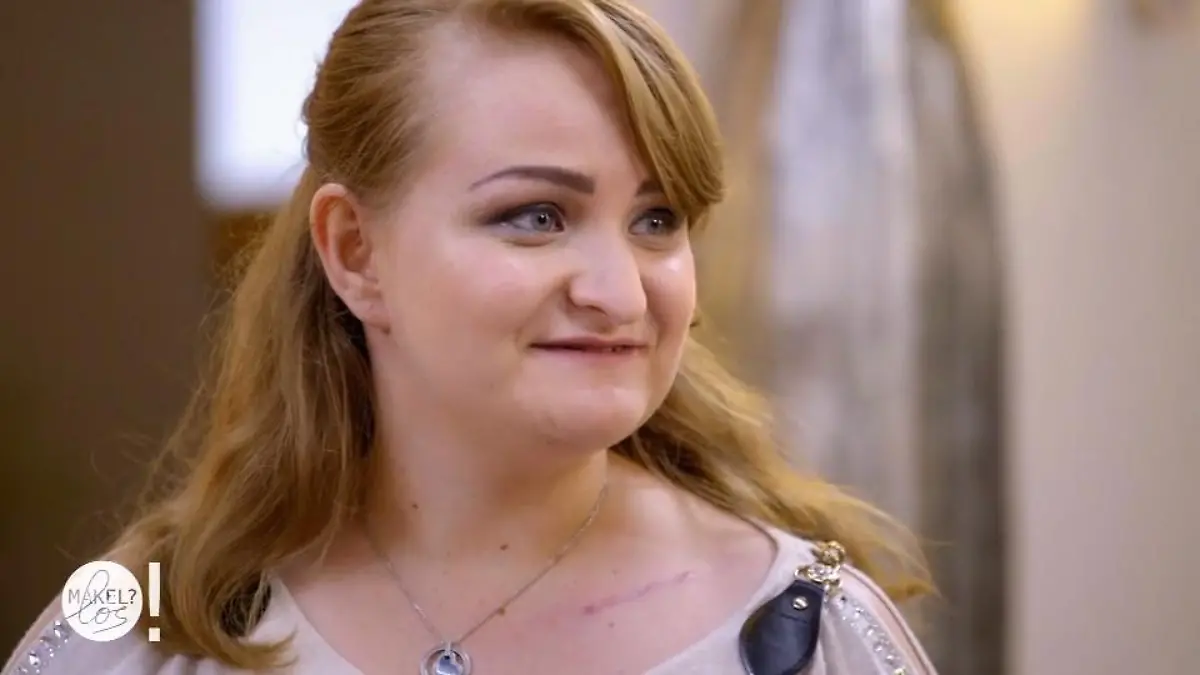 Schlimme Erinnerungen werden wach: Katja möchte ihre Narbe verdecken