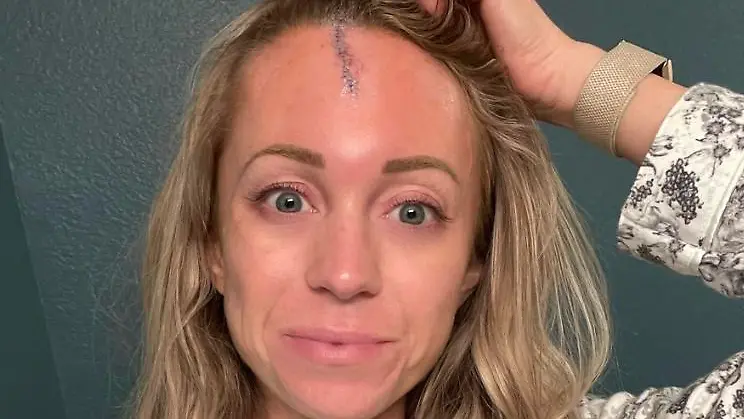 TV-Reporterin von Baseball übel am Kopf erwischt - jetzt zeigt sie ihre ...