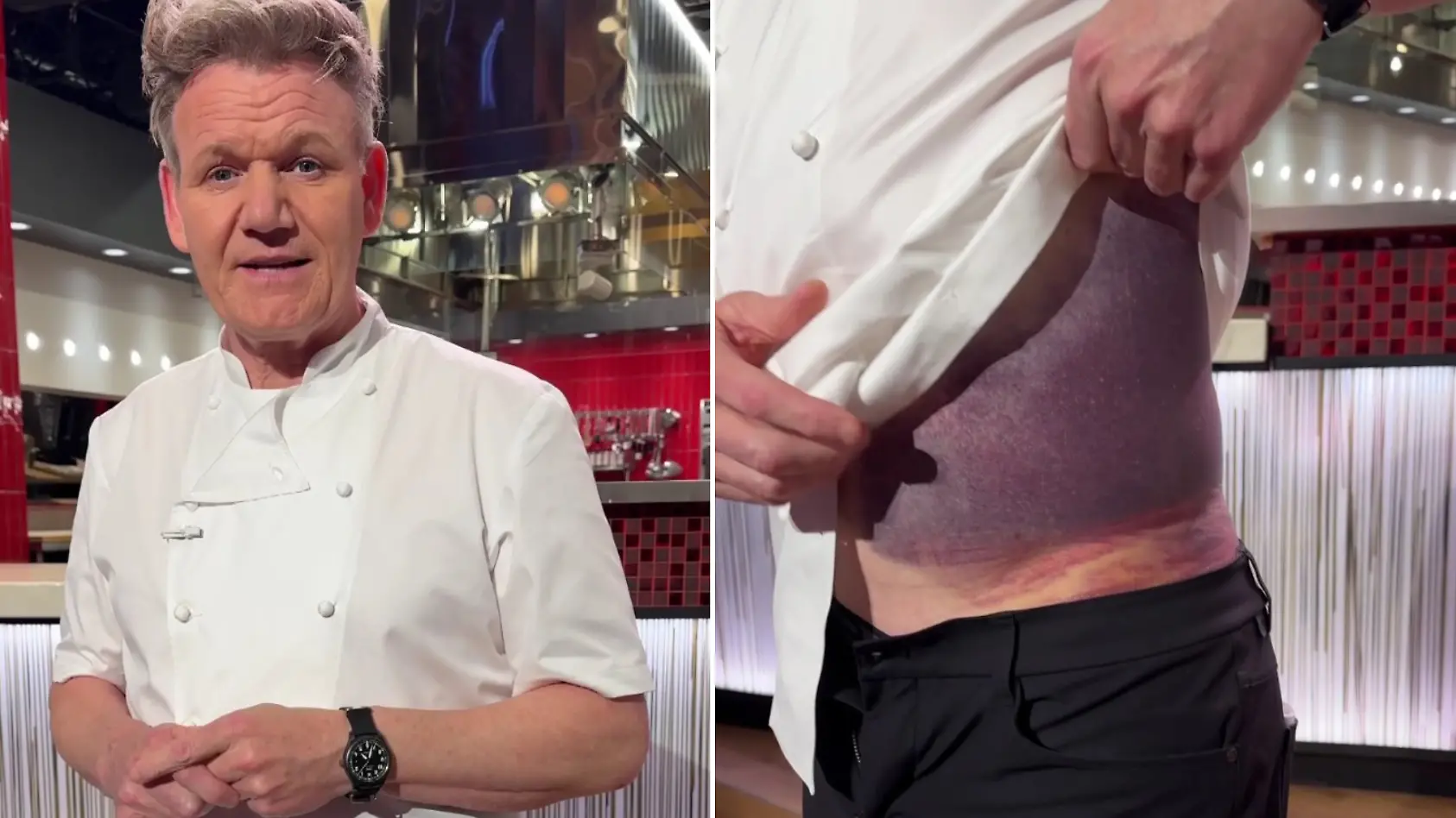 Gordon Ramsay bei Fahrradunfall fast gestorben! Jetzt zeigt der TV-Koch ...