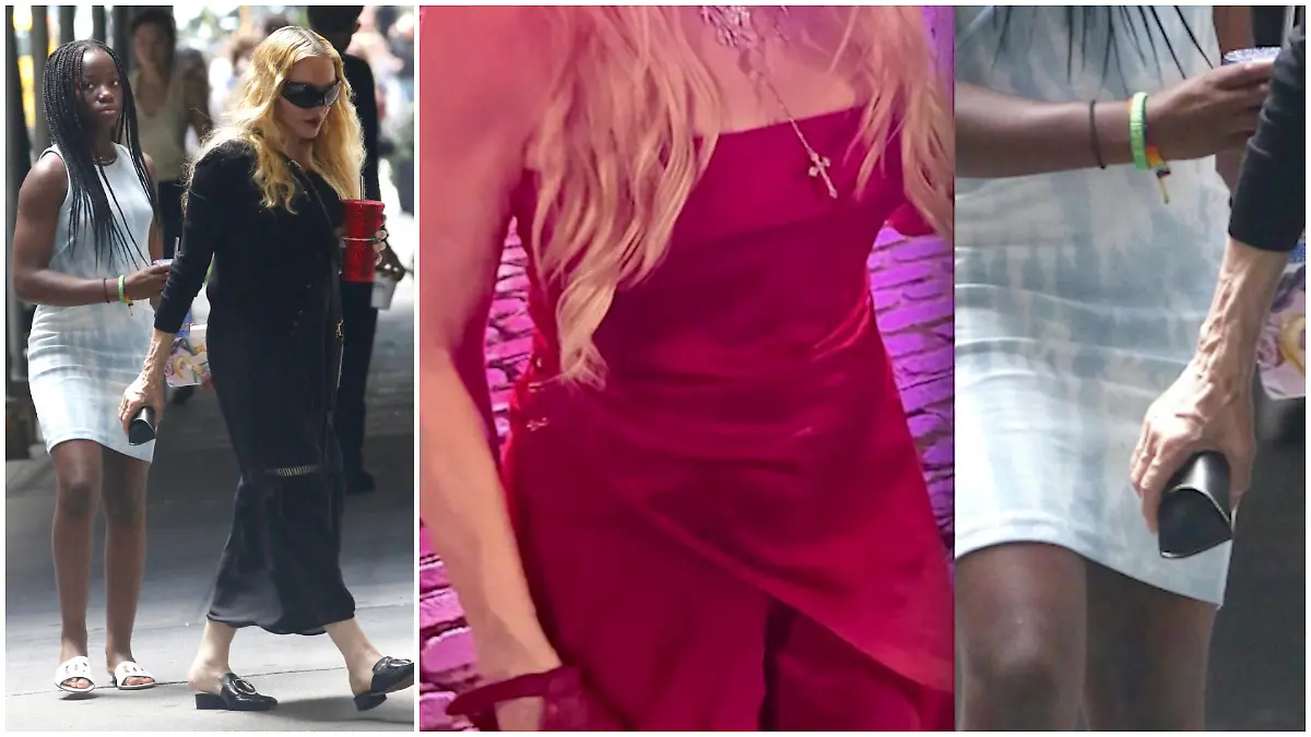 Madonna mit riesigen Adern: Paparazzi-Bilder lassen Insta-Pfusch auffliegen