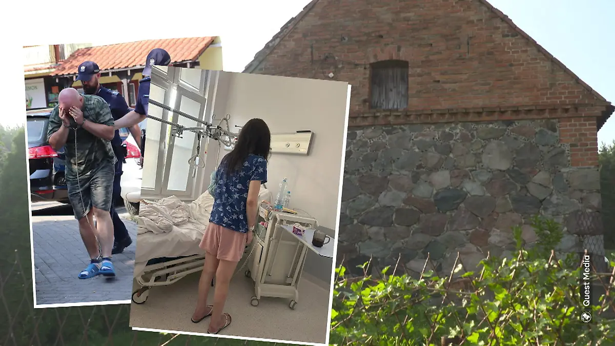 Małgorzata verliert durch Polen-Fritzl Lippen und Zähne