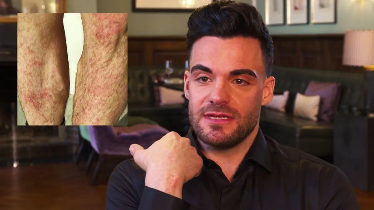 Hefe längst abgelaufen? Mit diesem Trick erkennt ihr, ob sie noch ...