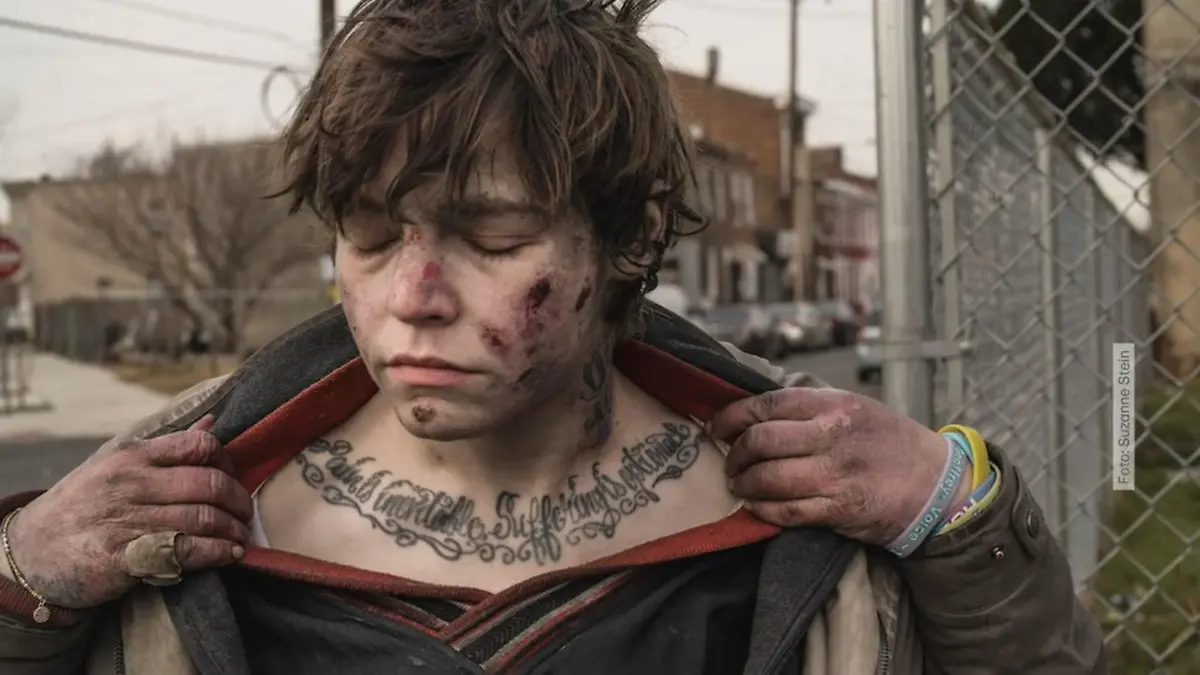 Schicksal Drogensucht: TRANQ: Die Zombie-Droge überschwemmt die USA