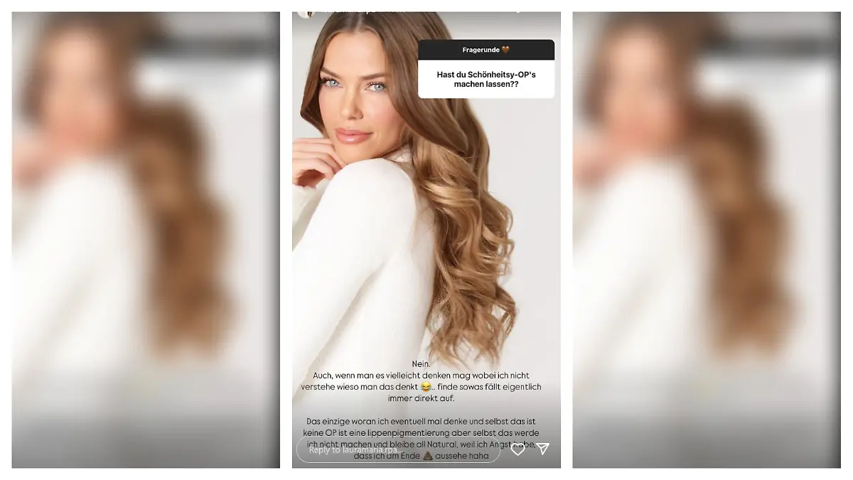 Laura Maria Rypa: War Pietro Lombardis Verlobte beim Beauty-Doc?