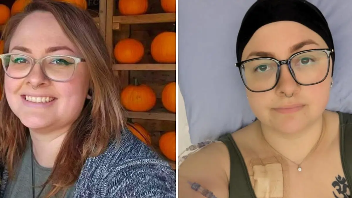 Taylor (32) denkt jahrelang, sie hat Ekzeme – jetzt hat sie Krebs im ...