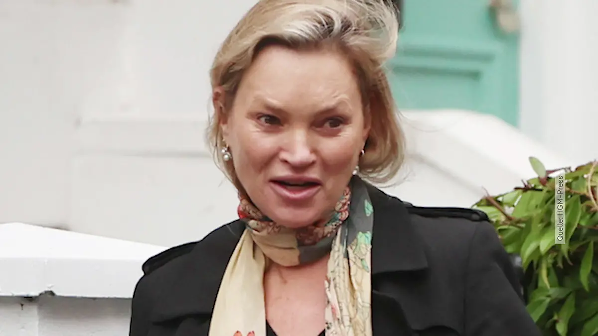Augenbrauen im Höhenflug: Botox-Unfall bei Kate Moss?