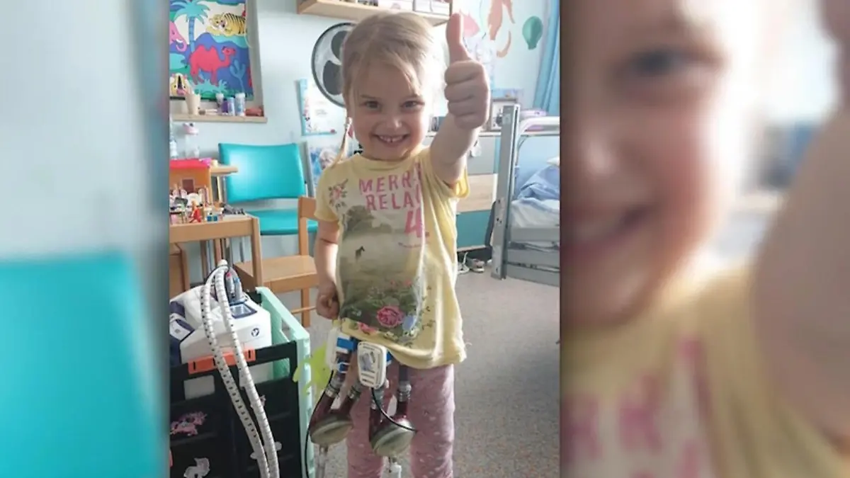 Fokale Epilepsie: Vanessa Locks Tochter Leni lebt mit einem halben Gehirn