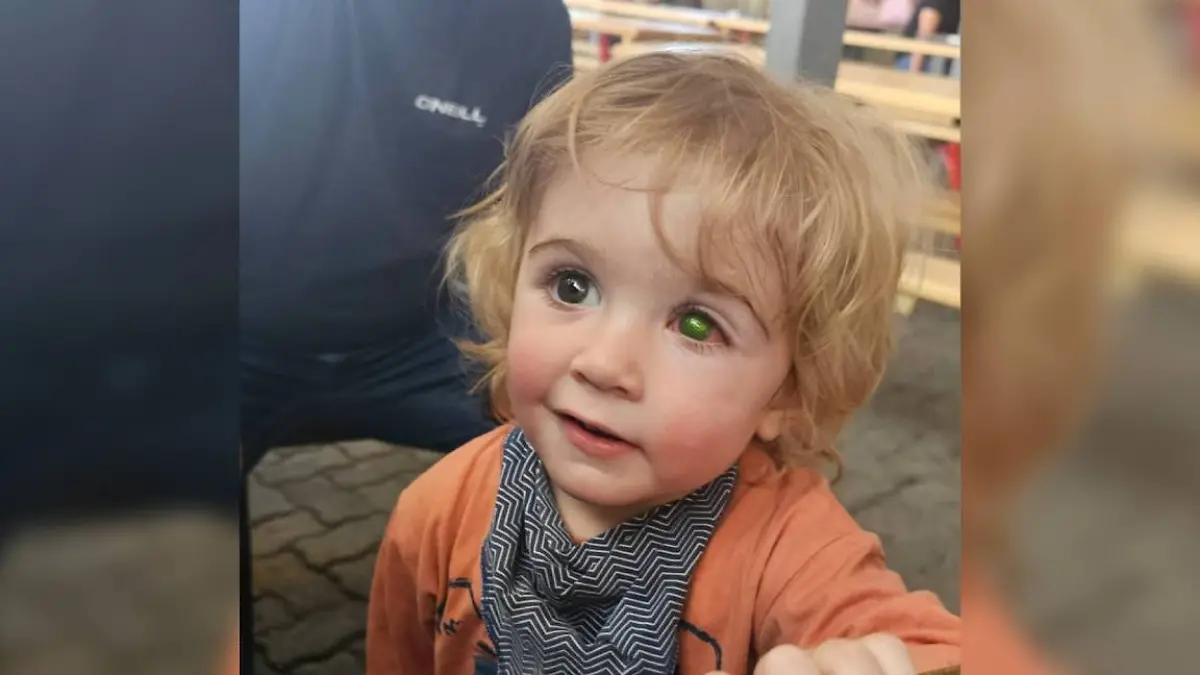 Kind blind: Herpesvirus kostet Juwan (2) sein Augenlicht