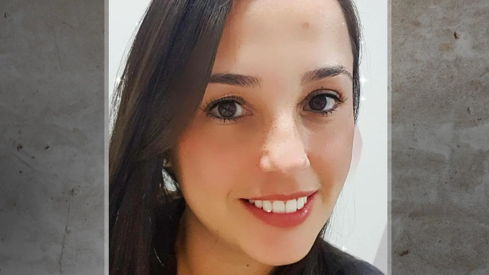 Brasilien: Mutter (35) stirbt nach drei Schönheits-OPs - Gesundheitsamt untersucht den Fall