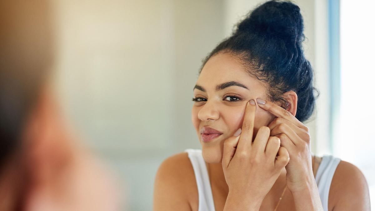 Unterirdische Pickel: Diese Fehler machen fast alle