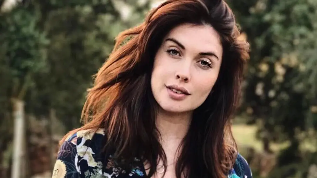 Ex-"GNTM"-Star Ira Meindl macht Trennung von ihrem Mann Deniz öffentlich