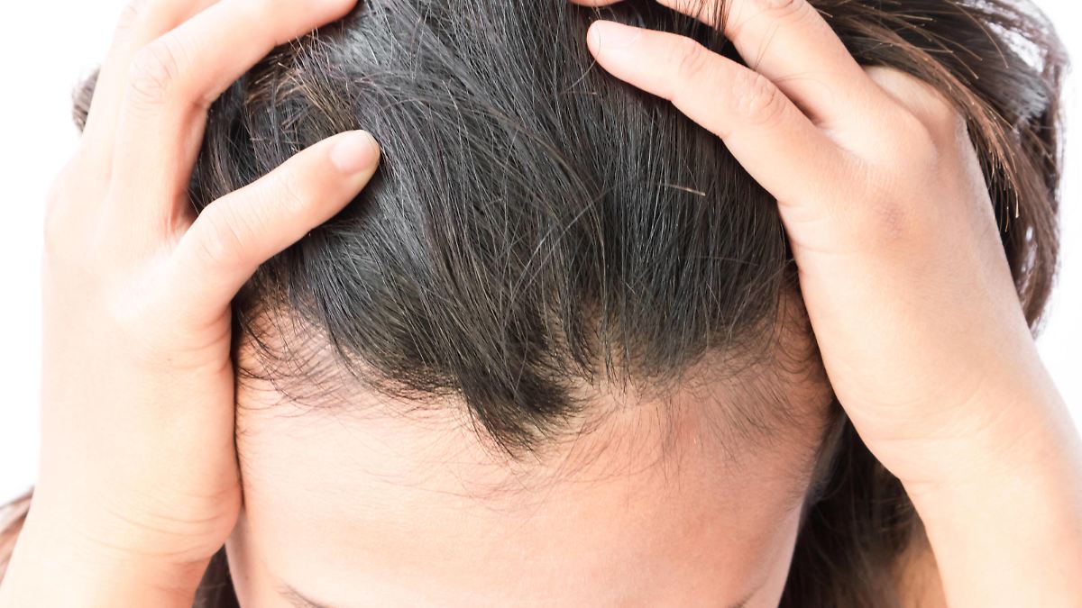 Führen Extensions zu dünneren Haaren und Haarausfall?