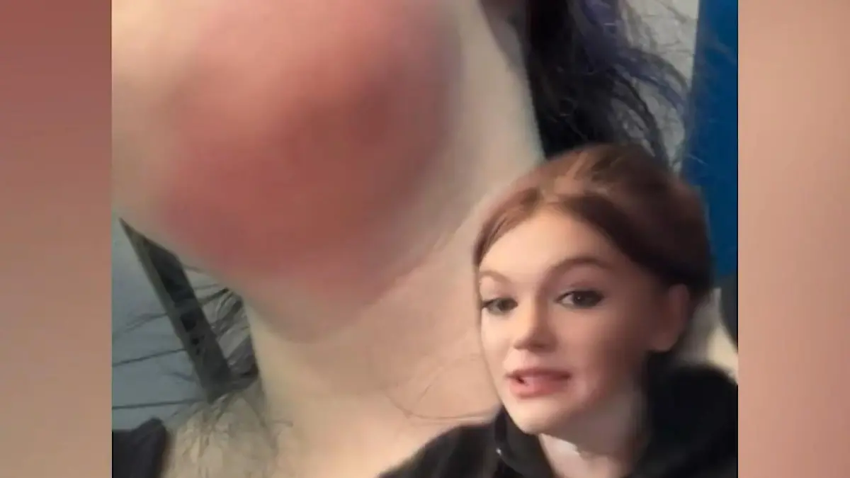 Beim Spielen mit dem Hund: Courtney (19) stirbt beinahe - weil ihr ein ...