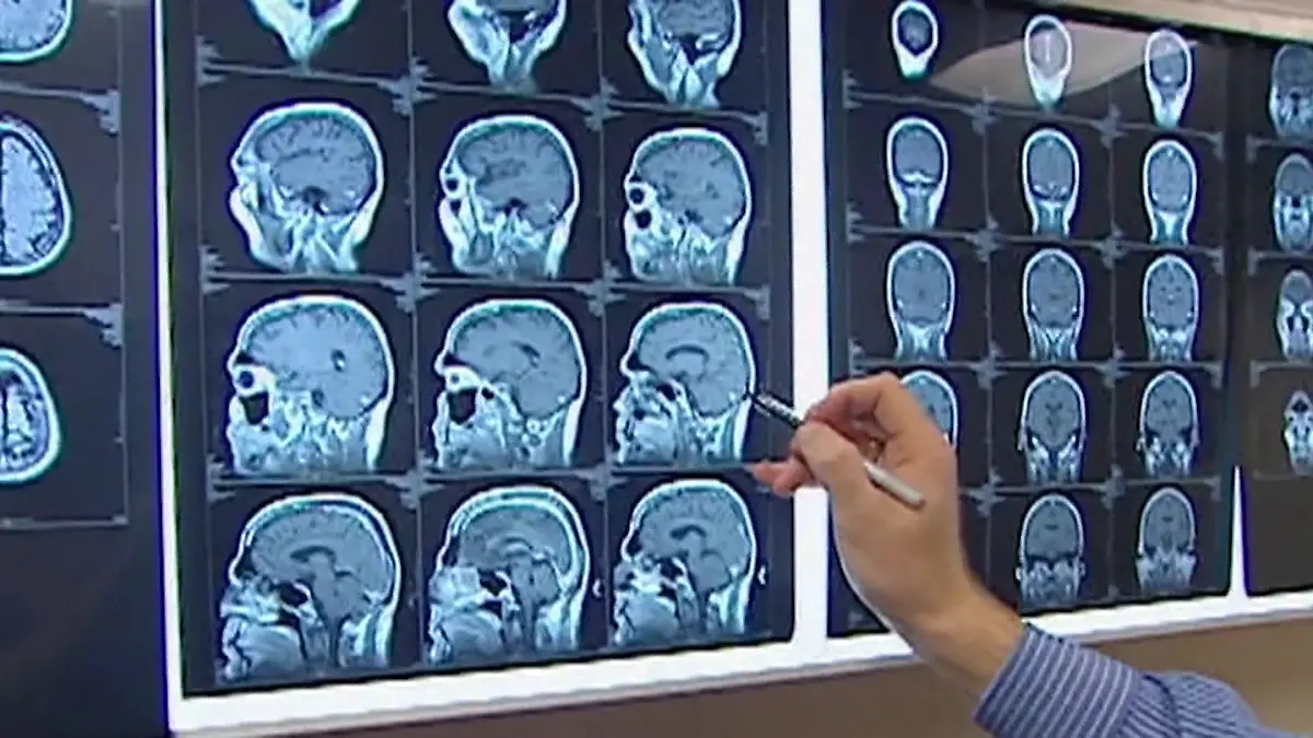 Model Phia Quantius: Wegen Migräne bin ich nur maximal vier Tage im ...