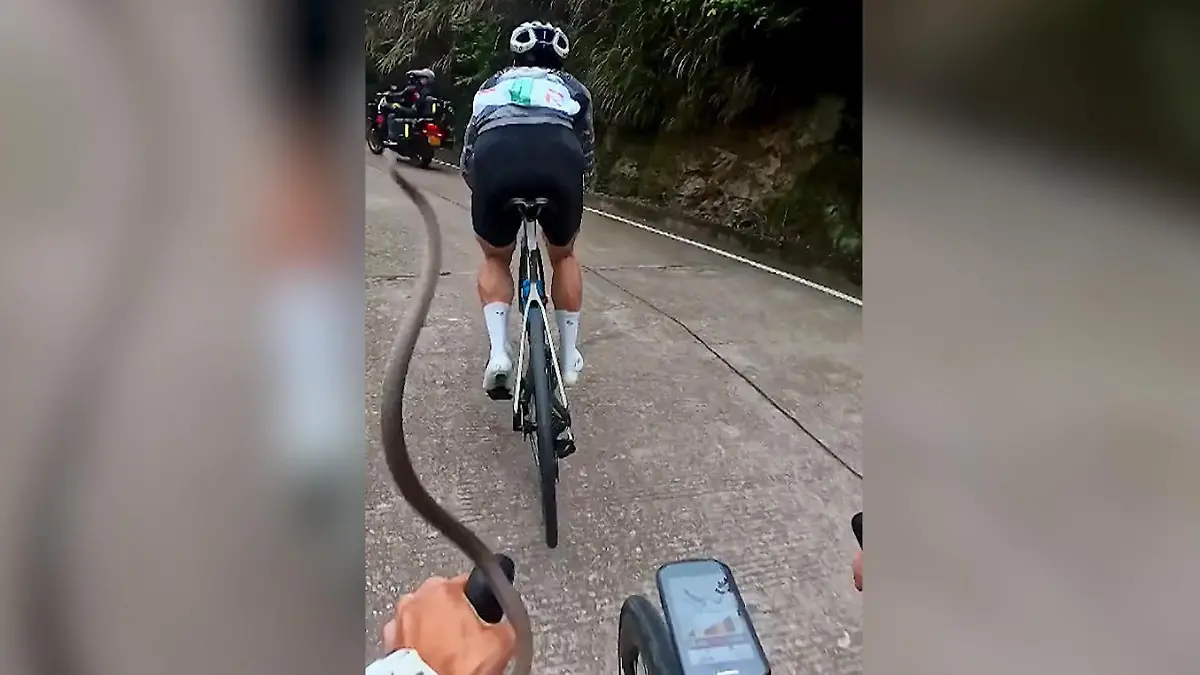 Model Phia Quantius: Wegen Migräne bin ich nur maximal vier Tage im ...