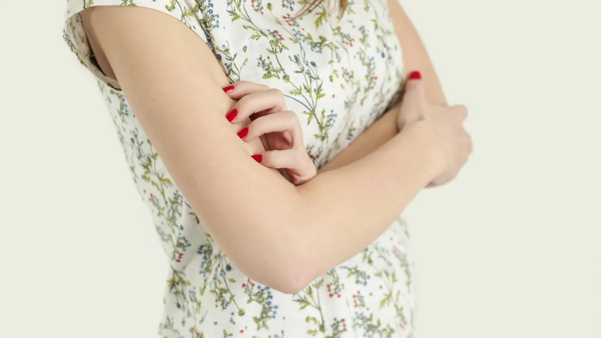 Gesundheitslexikon: Intertrigo (intertriginöses Ekzem, Hautwolf)