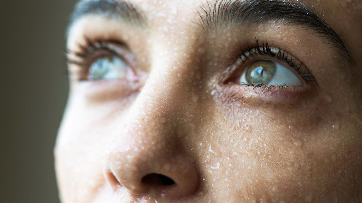 Hyperhidrose: Das hilft wirklich gegen krankhaftes Schwitzen