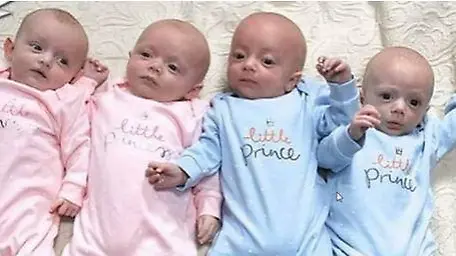 Ohne künstliche Befruchtung: Viereiige Vierlinge geboren