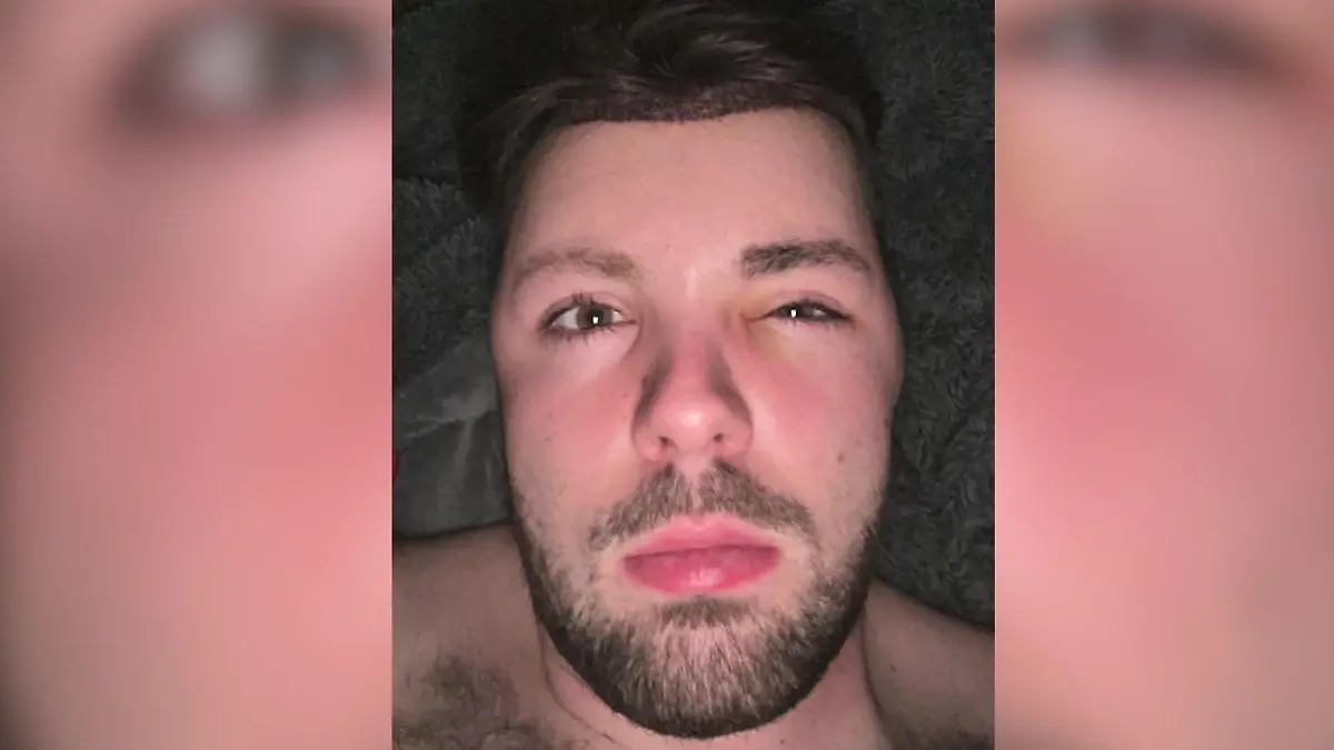 Die Gefahr lauert im Garten! Was das Borna-Virus ist und wie ihr euch schützen könnt