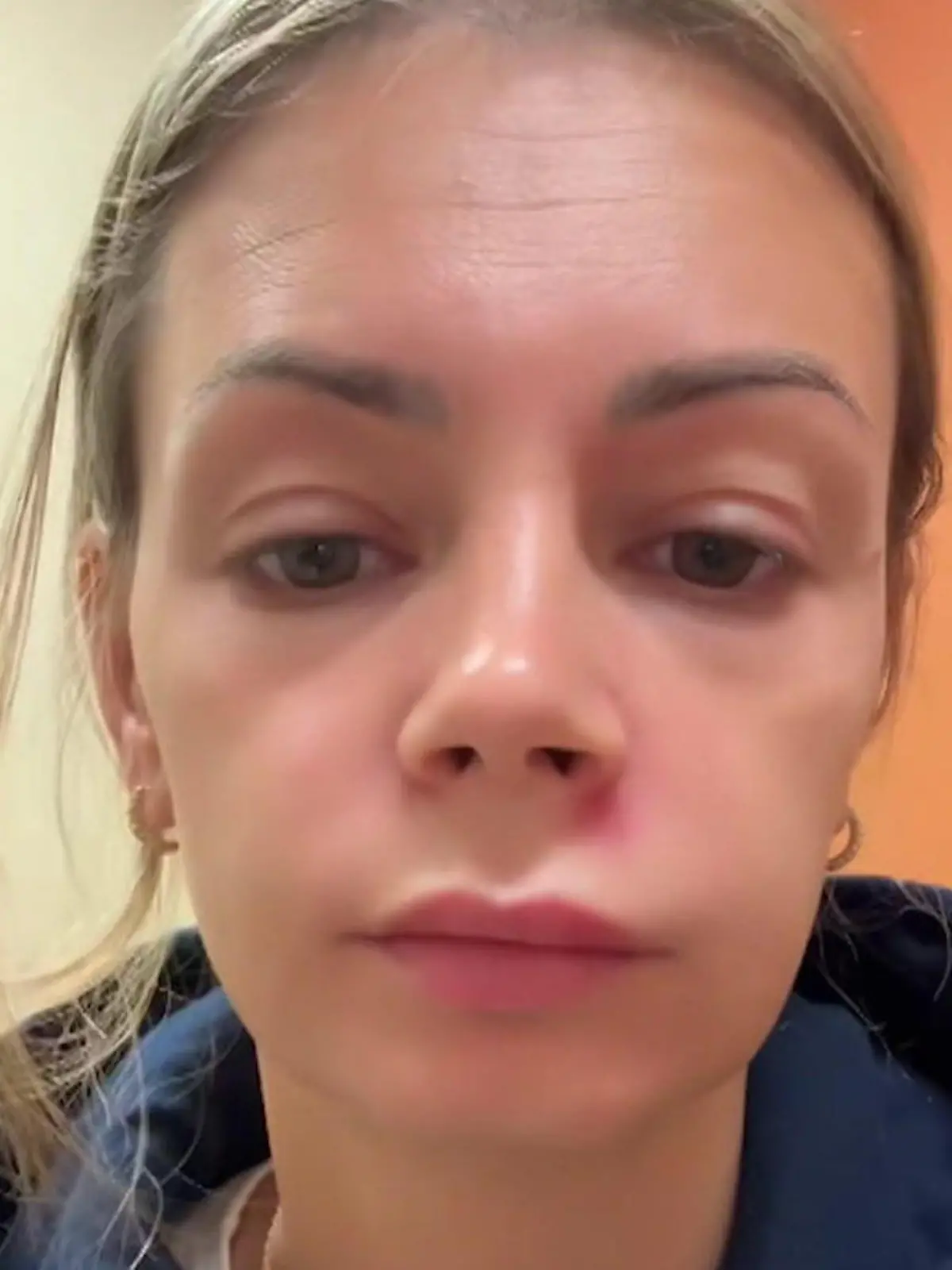 Seltene Gen-Erkrankung: Schock-Diagnose für Baby Summer! So gehen ...