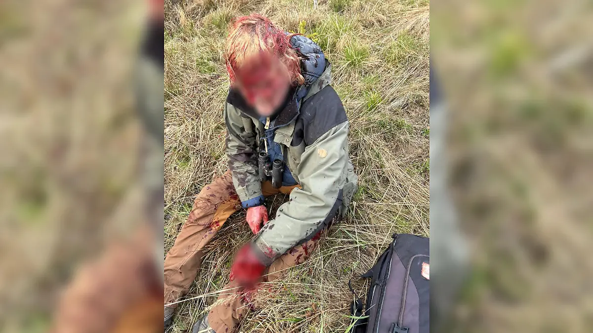 Bären-Angriff! Tierfilmer Andreas Kieling zeigt sich blutverschmiert im Netz