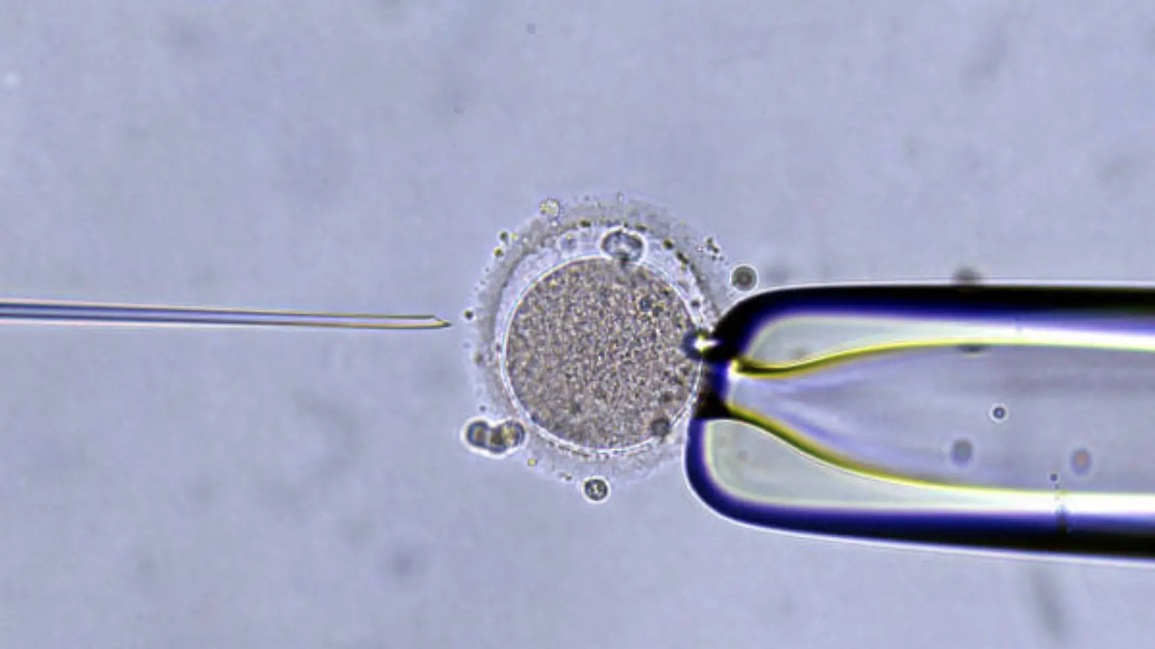 In-vitro-Fertilisation: IVF in sieben Schritten
