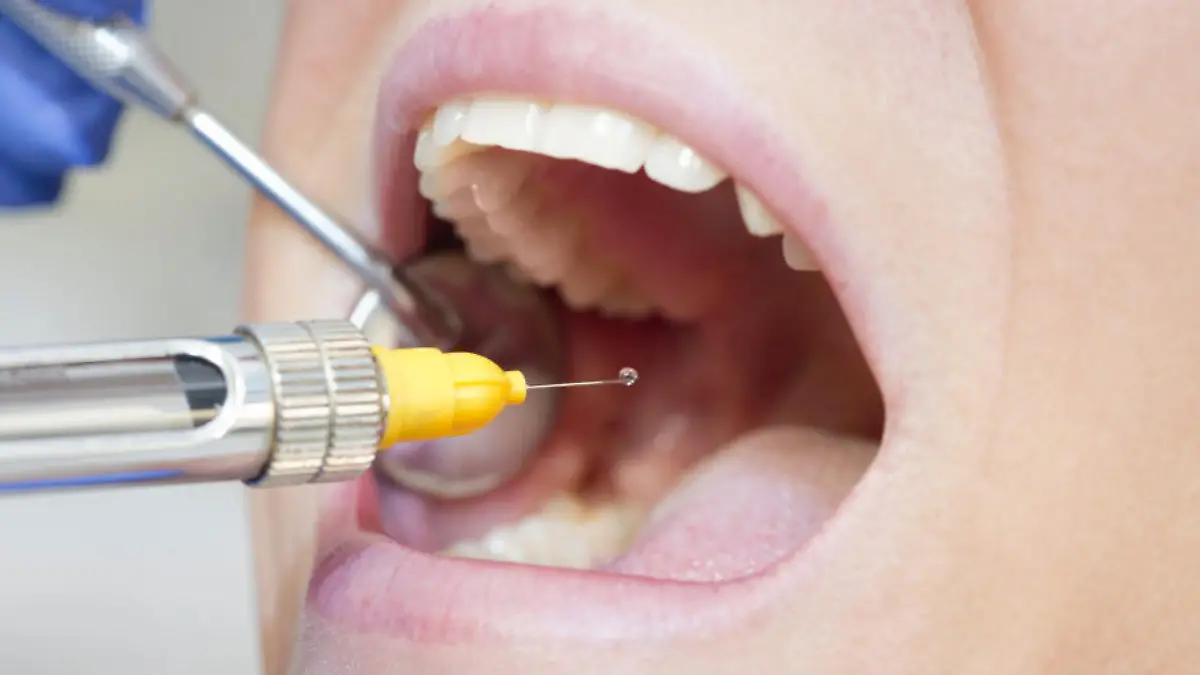 Botox Bei Zähneknirschen