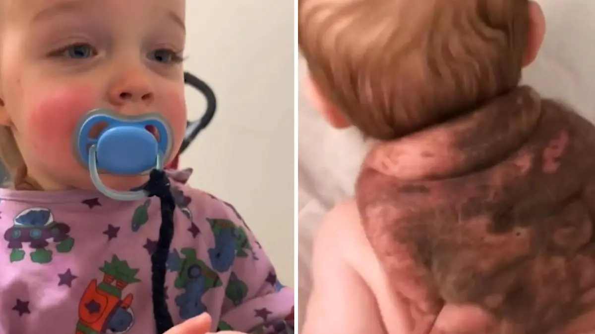 Seltene Erbkrankheit: Nach dem Tod ihres Bruders braucht Leonie (1 ...