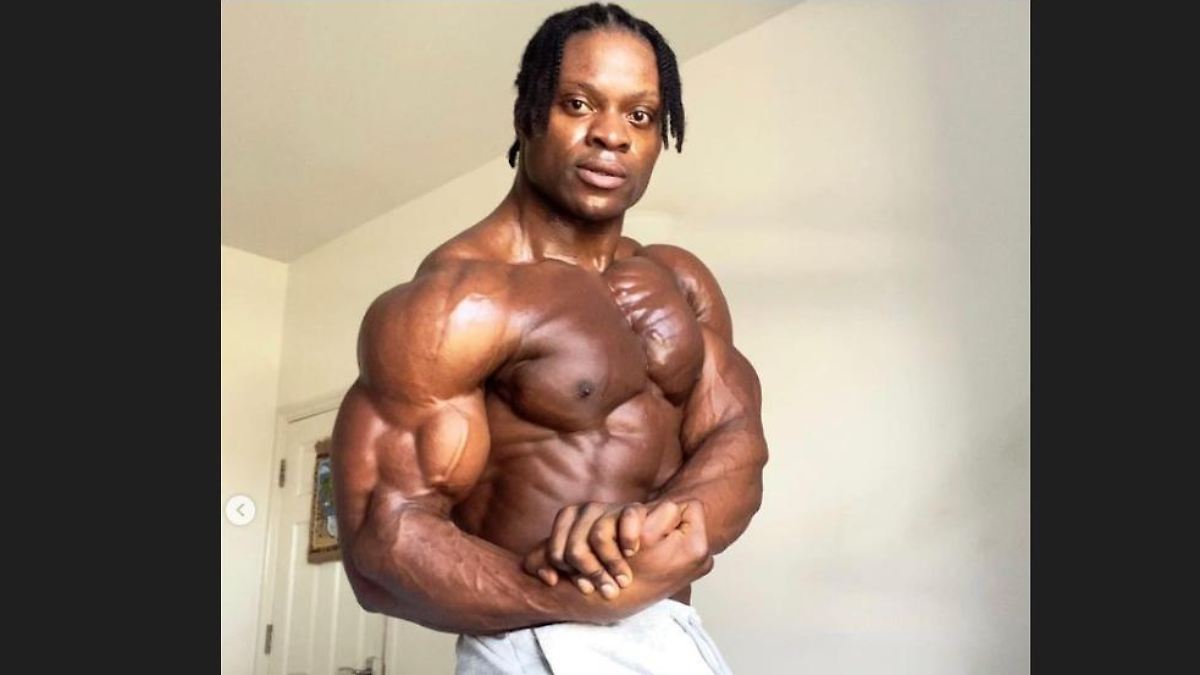 Fans bangen um Instagram-Star Armz Korleone: Horror-Verletzung bei ...