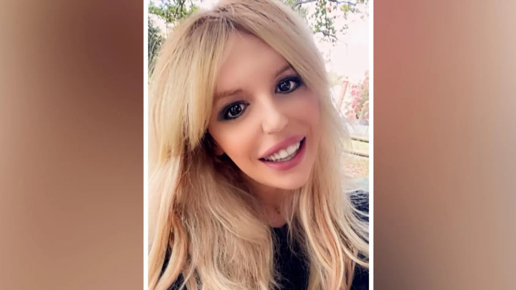 Um auszusehen wie Britney Spears: Bryan gibt 120.000 Euro für Schönheits-OPs aus